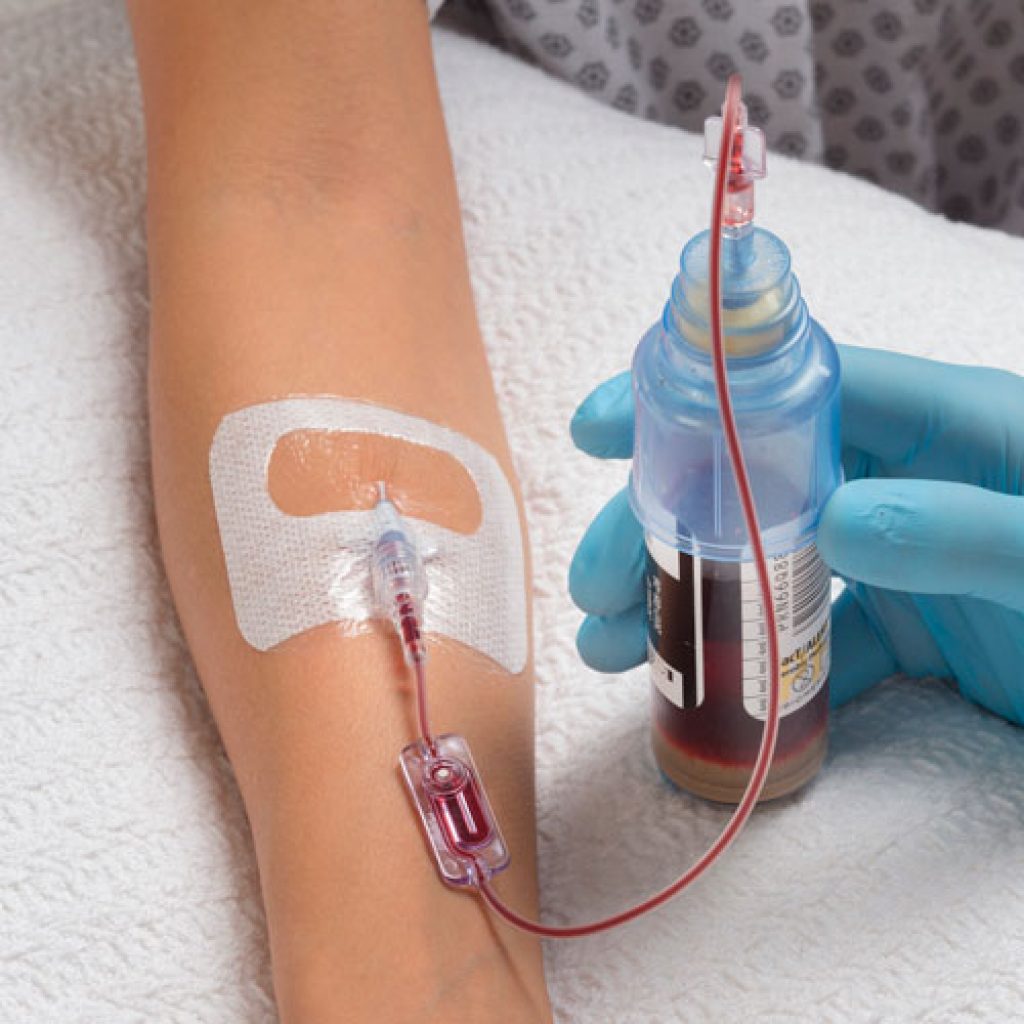 Kurin Lock® Specimen Diversion Device: Simple Diversion Solution | Kurin