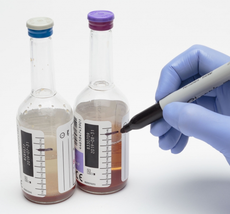 Blood Sample Contamination Fast Facts | Kurin Blood Sample Contamination Fast Facts | Kurin