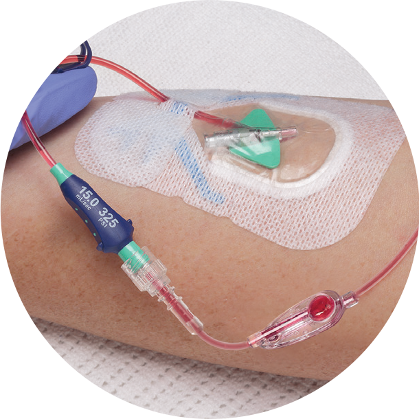 Kurin Lock® with Flash Technology: Better than conventional diversion ...