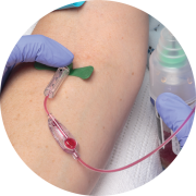 Kurin Lock® with Flash Technology: Better than conventional diversion ...